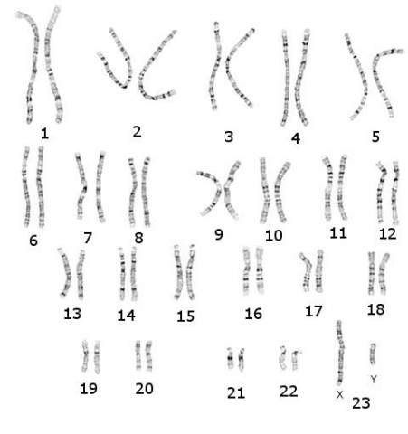 Homologe und autosome Chromosomen? (Menschen, Biologie)