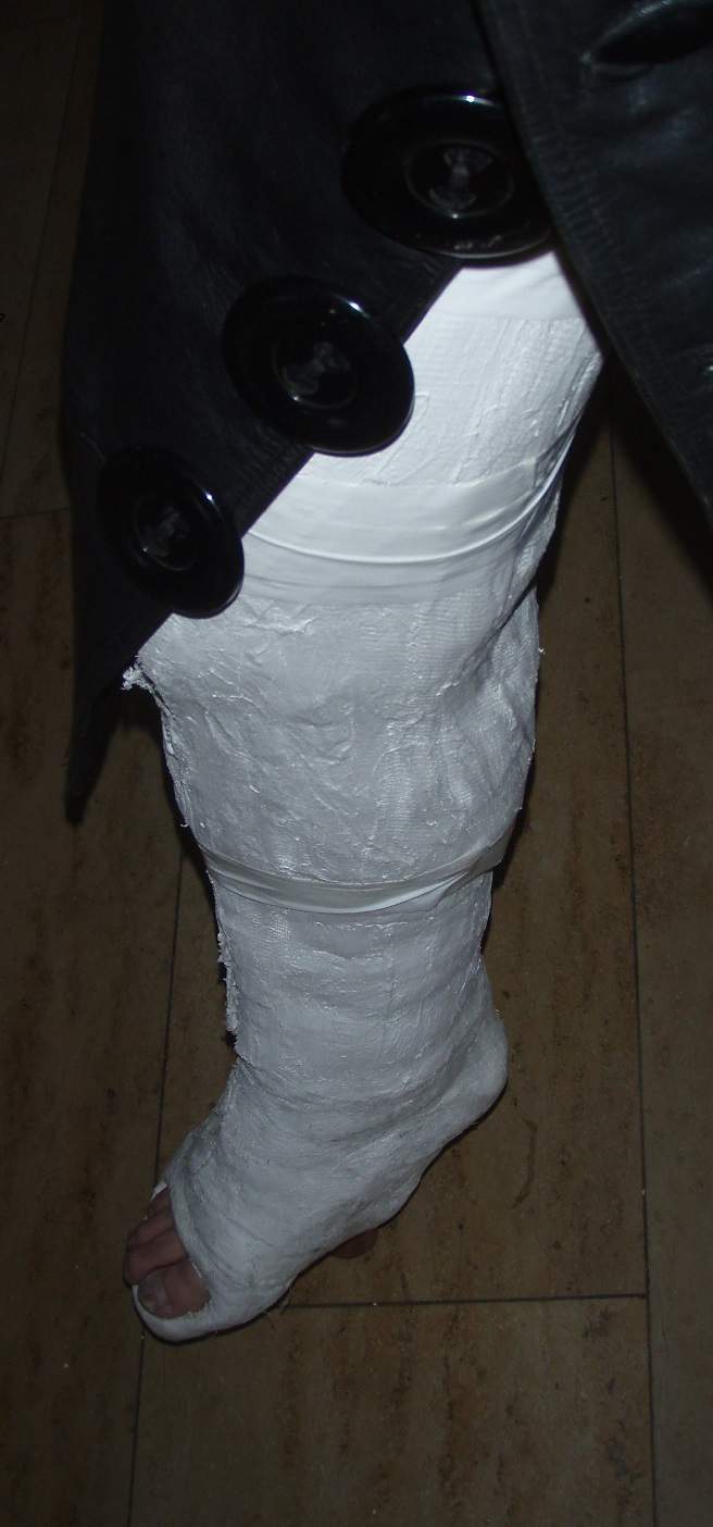 Gips bei knochenbruch wie lange tragen? (Gesundheit und Medizin)