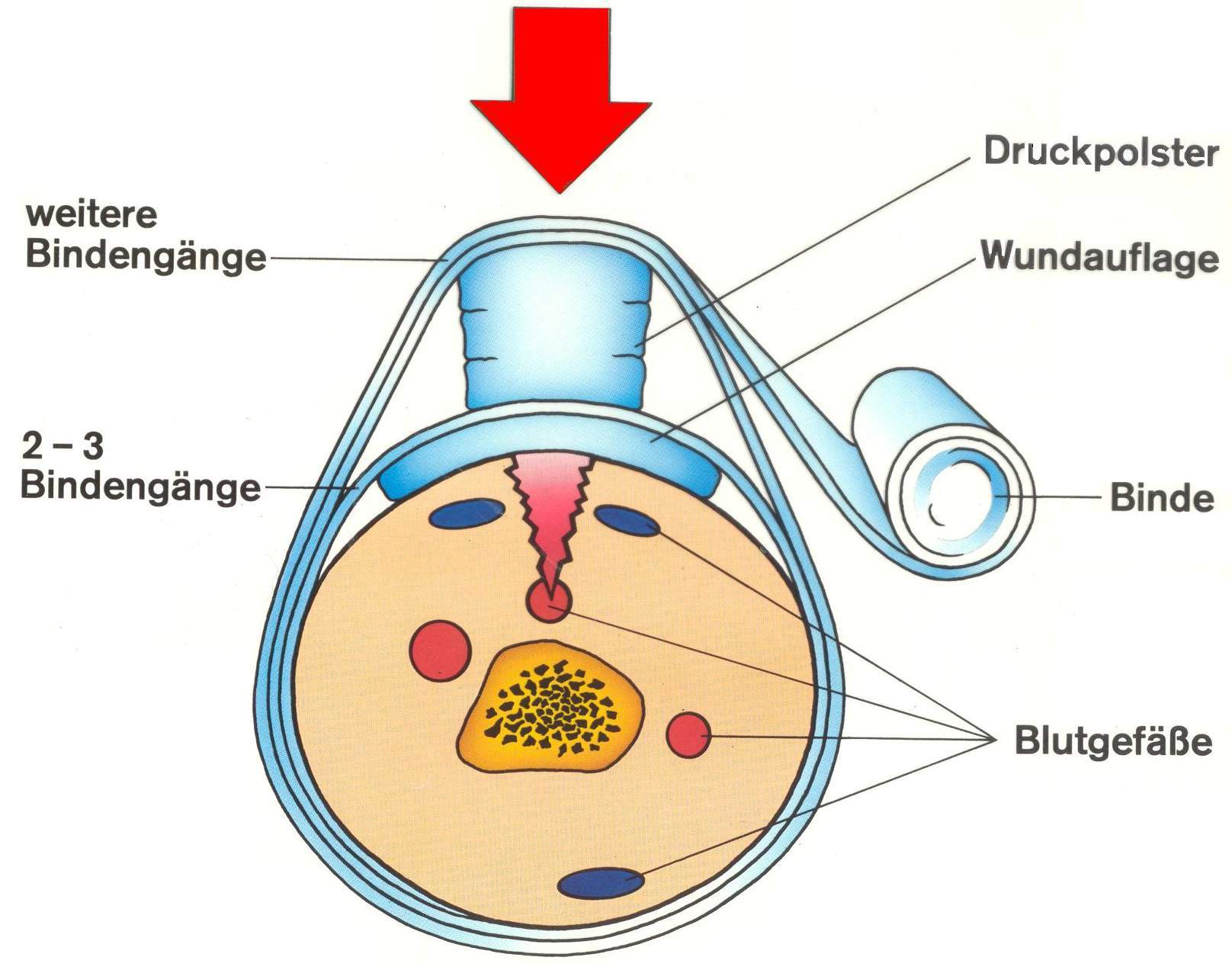 Erste-Hilfe Starke Blutung? (Erste Hilfe, Krankenwagen)
