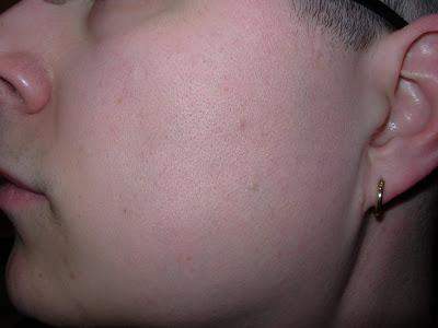 Was kann man gegen den Bartschatten machen? (Männer, Beauty, Gesicht)