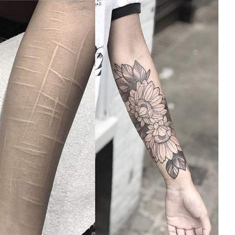 Tattoo über Narben vom ritzen? (Haut, tätowieren, Tätowierung)