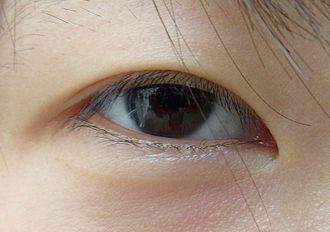 Was ist das für eine Augenform? Mandel? Rund? (Körper, Beauty, Aussehen)