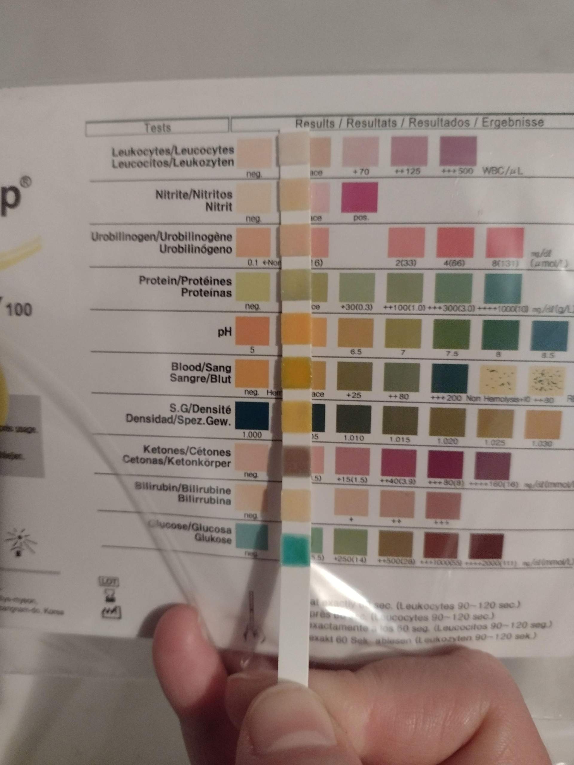 Analyse von Urintest, Ketone im Urin? (Gesundheit und Medizin)