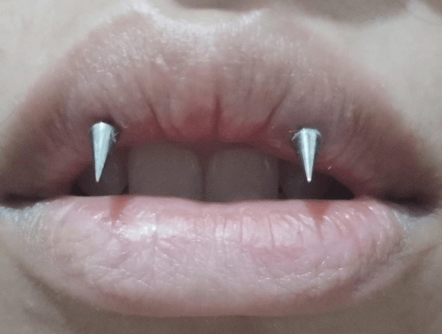 Angel Fangs? Was muss ich sagen? (Piercing, Piercer, Piercingschmuck)