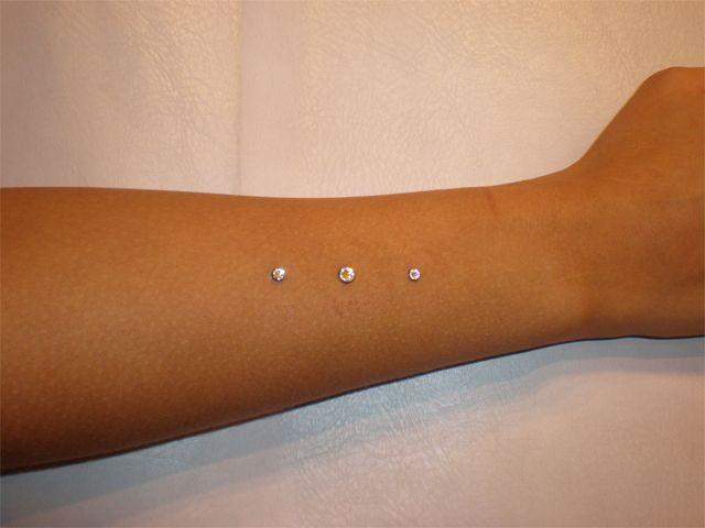 Arm Piercing? (Umfrage, Abstimmung, Piercingschmuck)