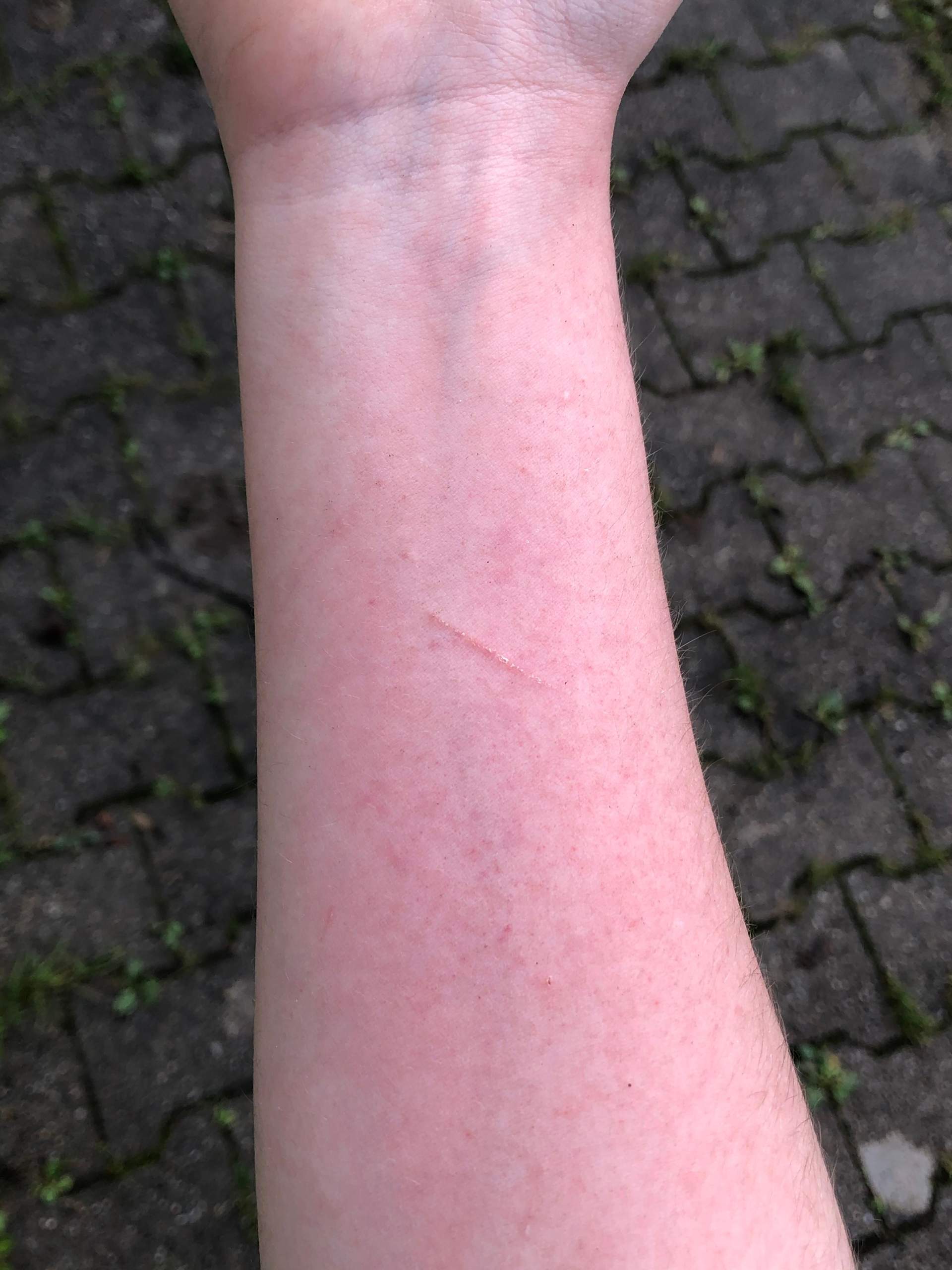 Arm rot geworden beim Volleyball spielen? (Sport und Fitness)