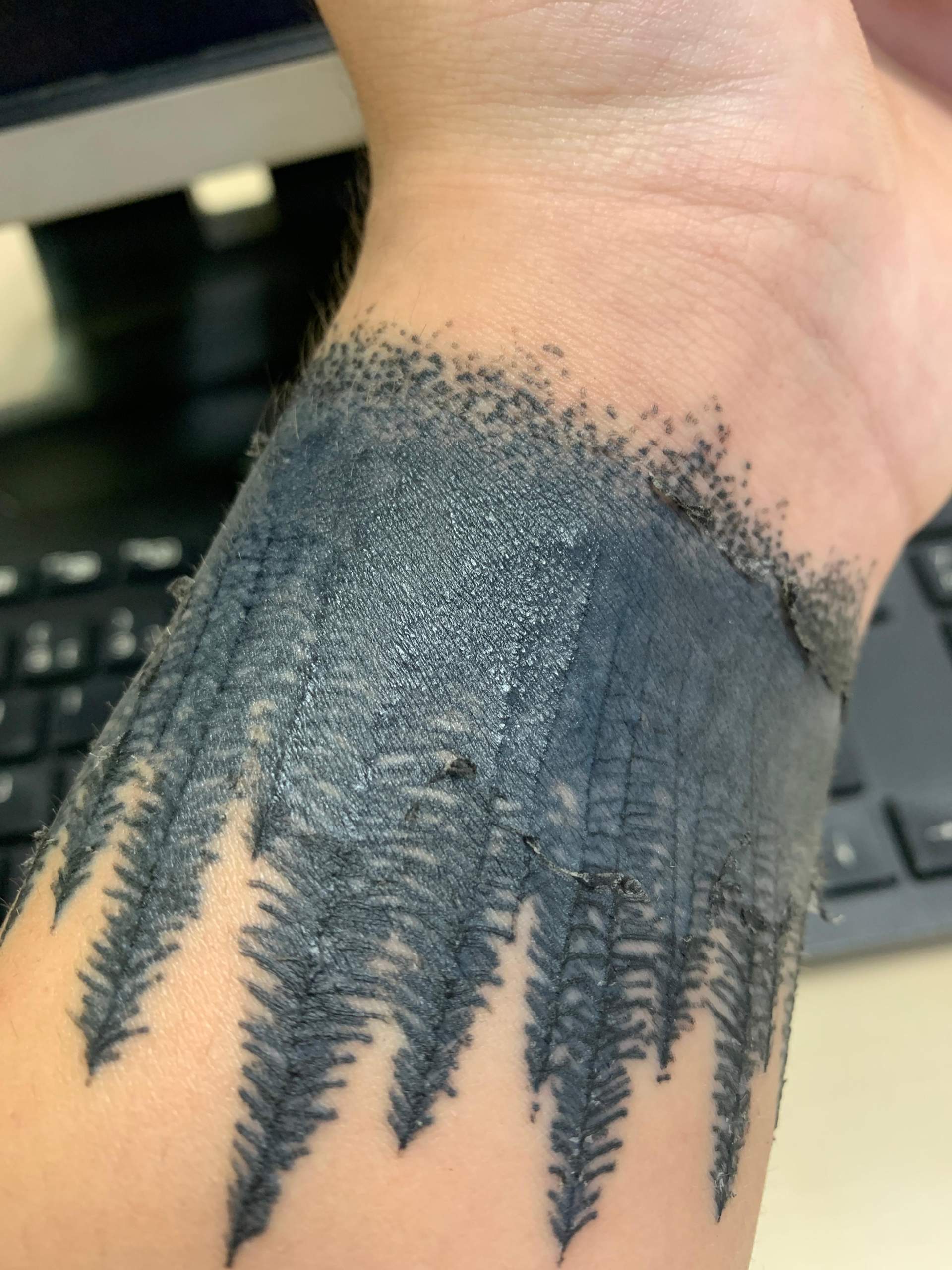 Kleine Pickel Tattoos Was Sind Das Für Rote Pinkelchen Um Mein Neues