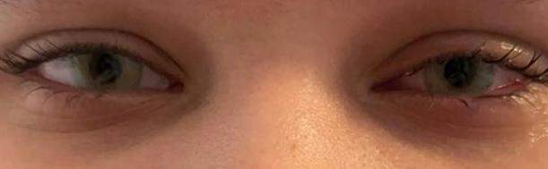 Augen? (Mädchen)