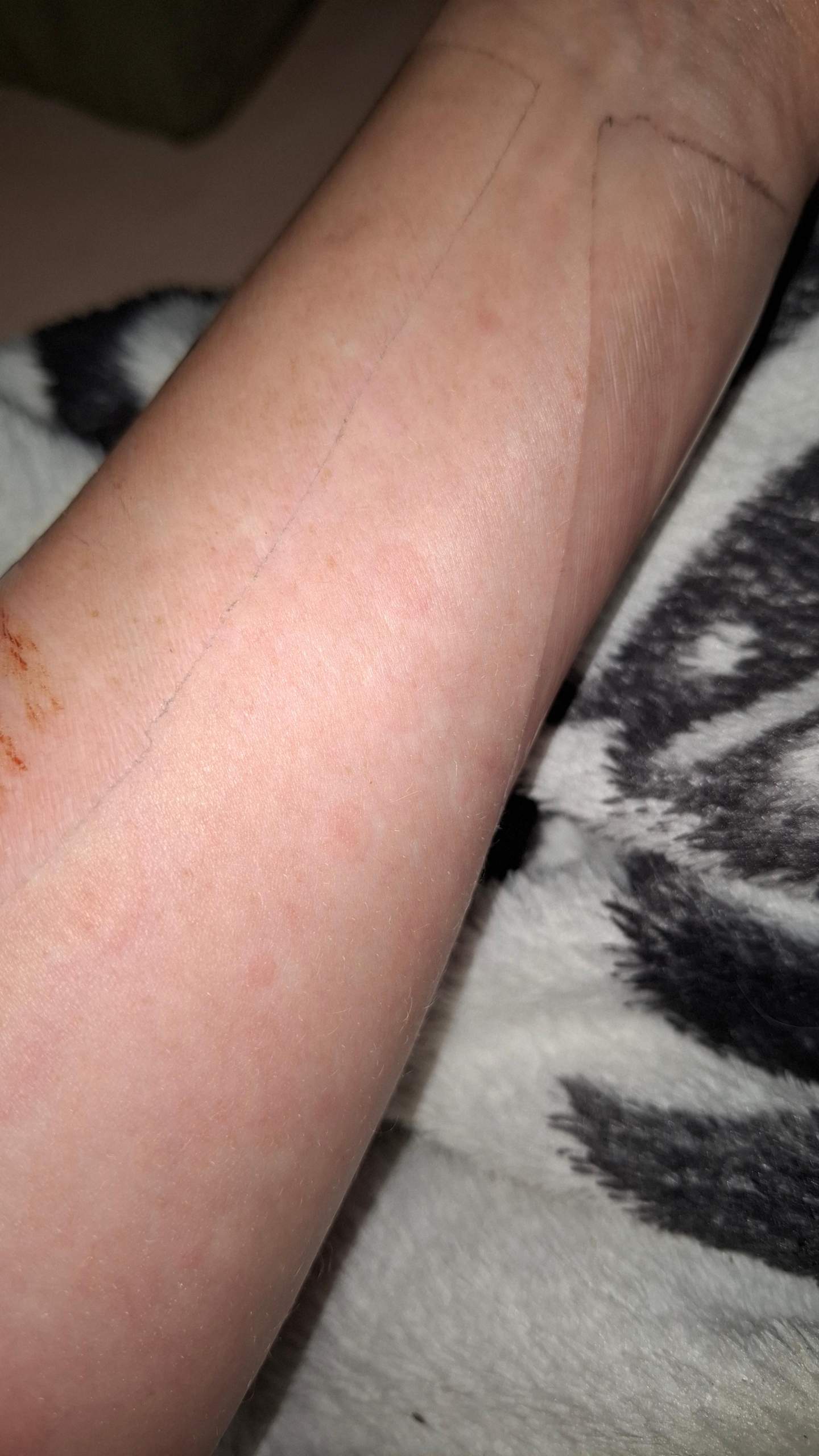 Ausschlag frisches Tattoo Folie? (Körper, Schmerzen, Aussehen)