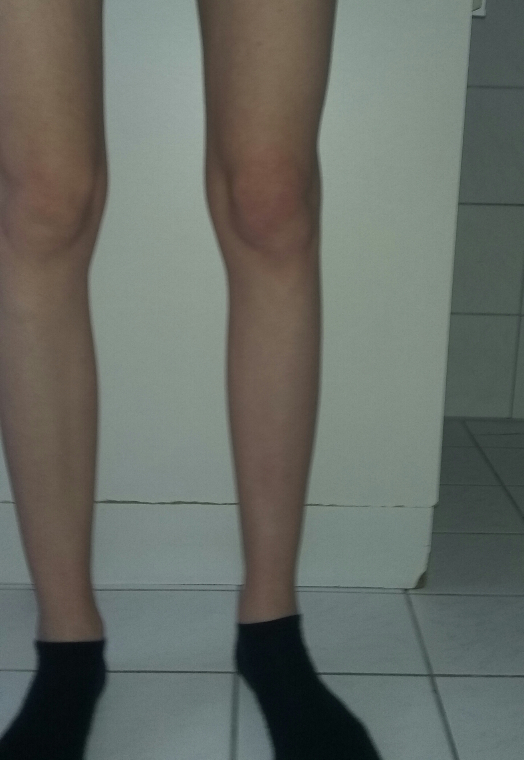 Beine sind nicht schön? (Phase)