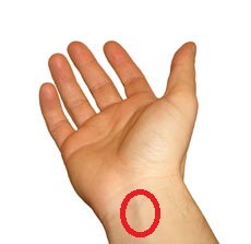 beule/schwellung an der innenseite vom handgelenk (Medizin)