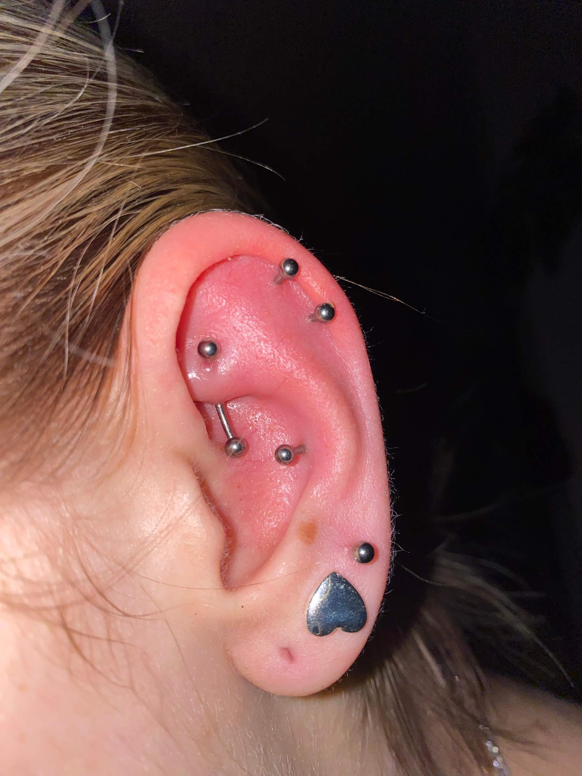Bildet sich bei meinem Rook wild Fleisch? (Wildfleisch, rook piercing)