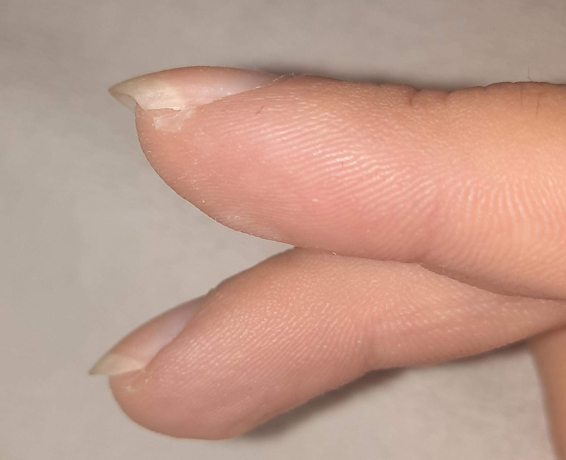 Blaue Fingernägel/Nagelbett? (blau)