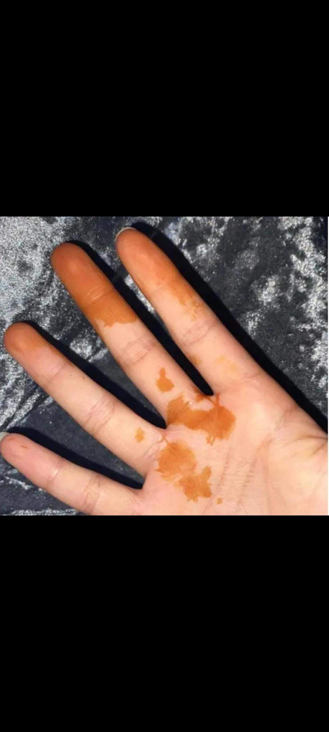 Braune Flecken an der Hand? (braun, gruselig, wtf)