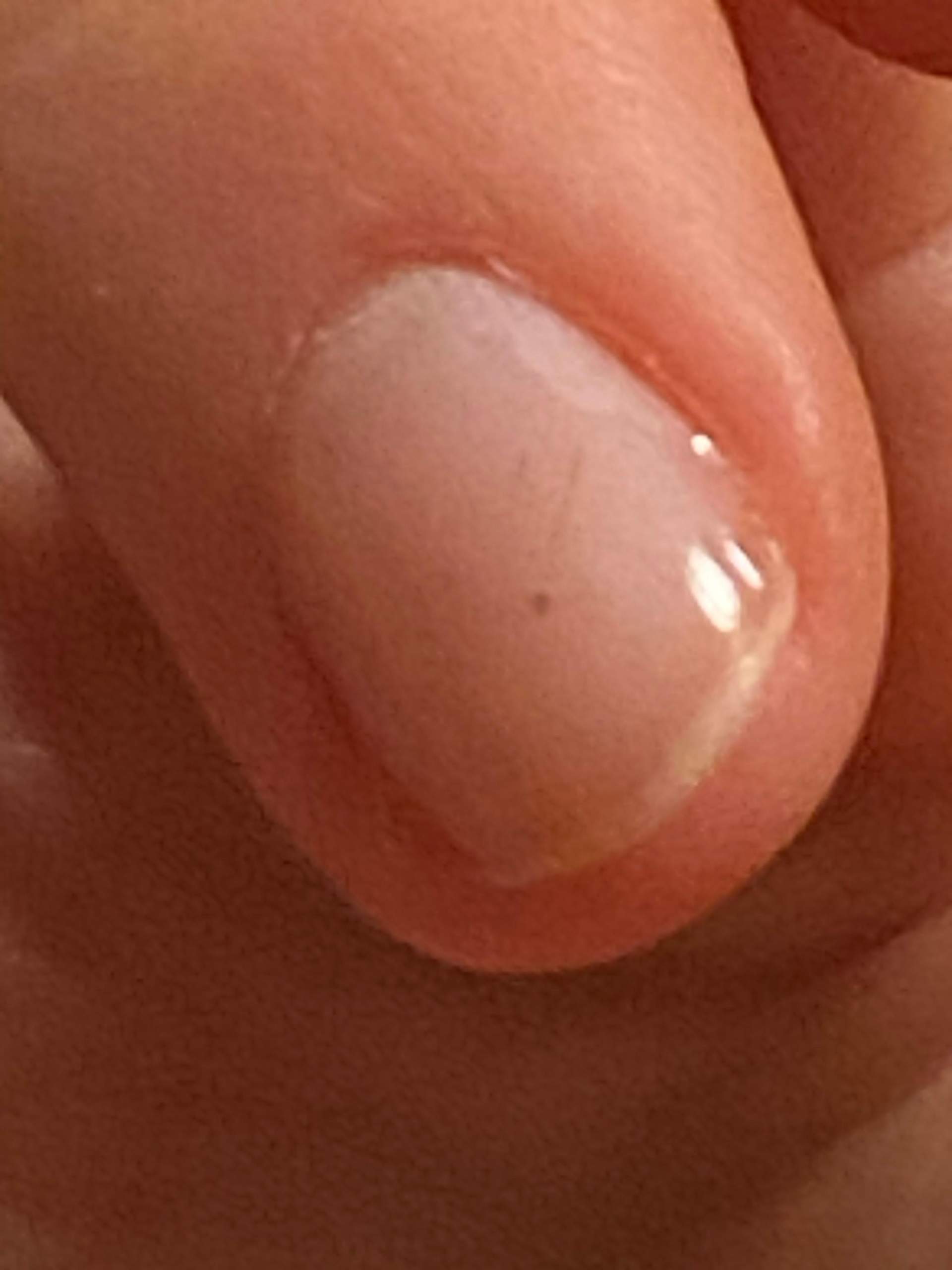Brauner Punkt unter dem Nagel? (Gesundheit, Nägel, Hand)