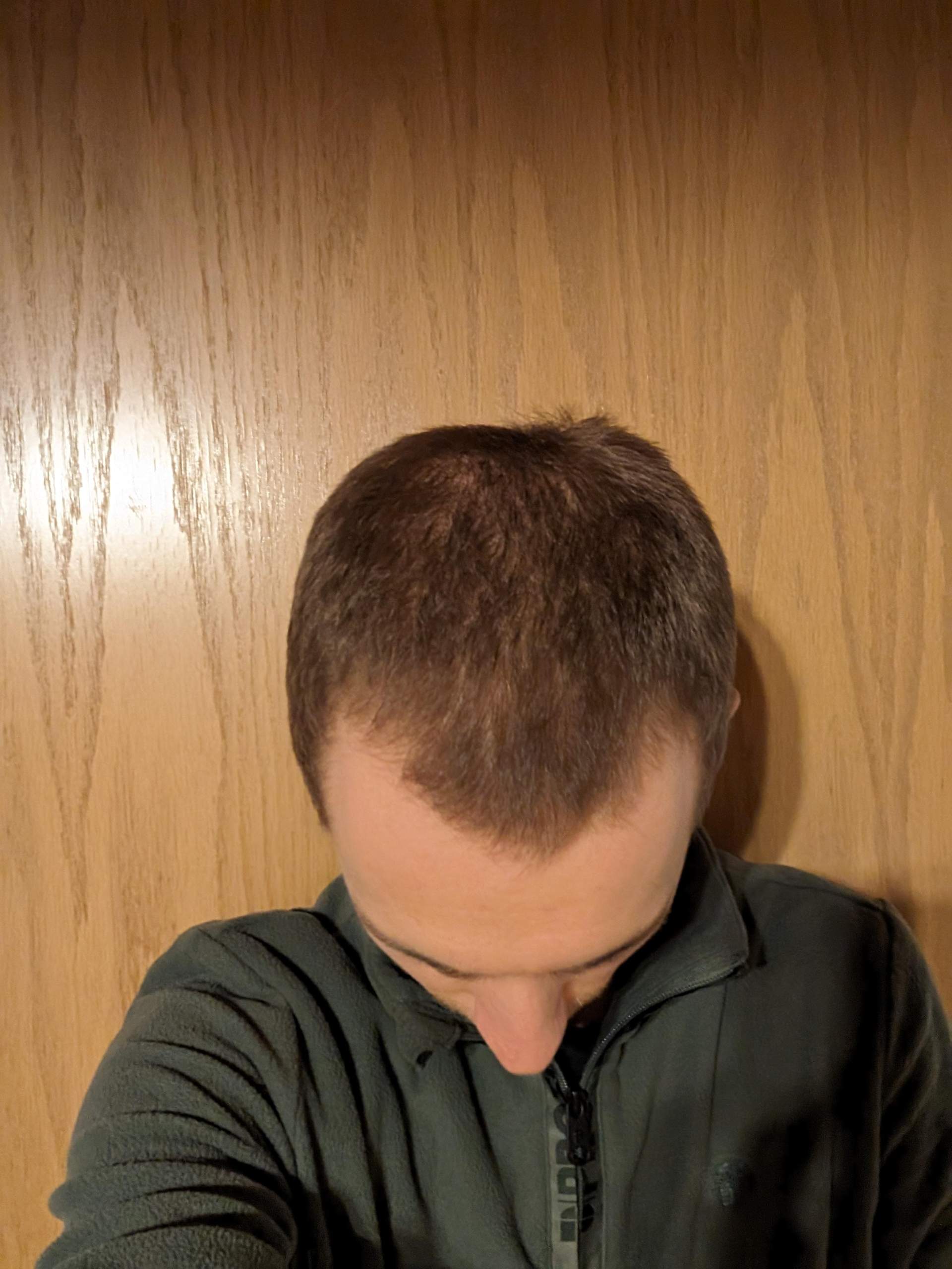 Buzz Cut oder längere Haare? (Männer, Styling, Haarschnitt)