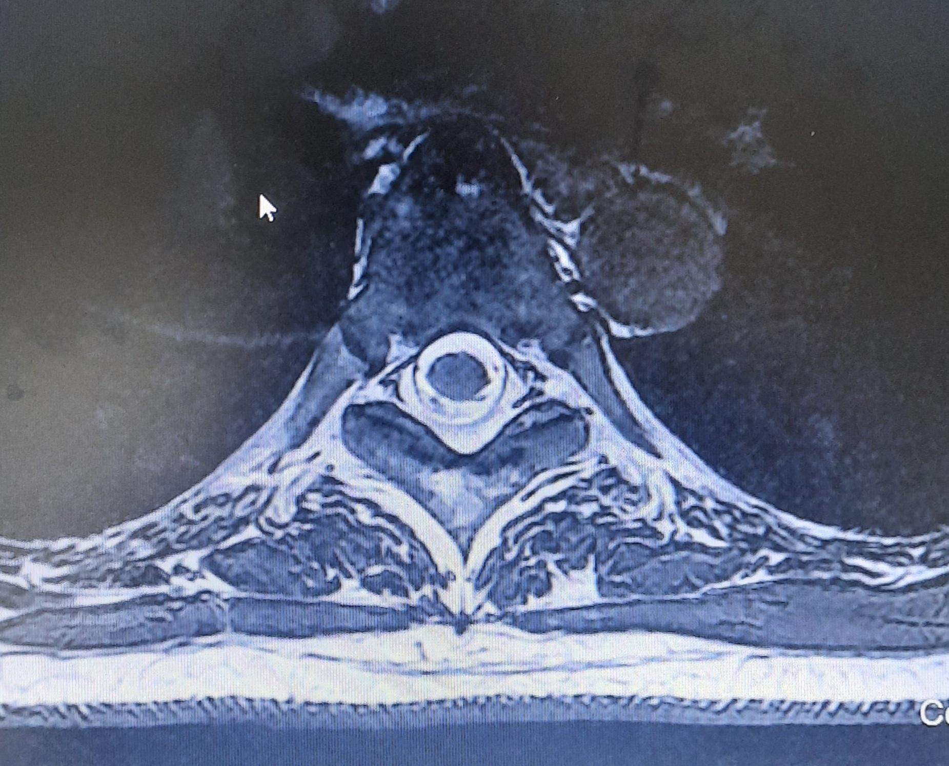 Bws schmerzen mrt bild? (Gesundheit und Medizin)