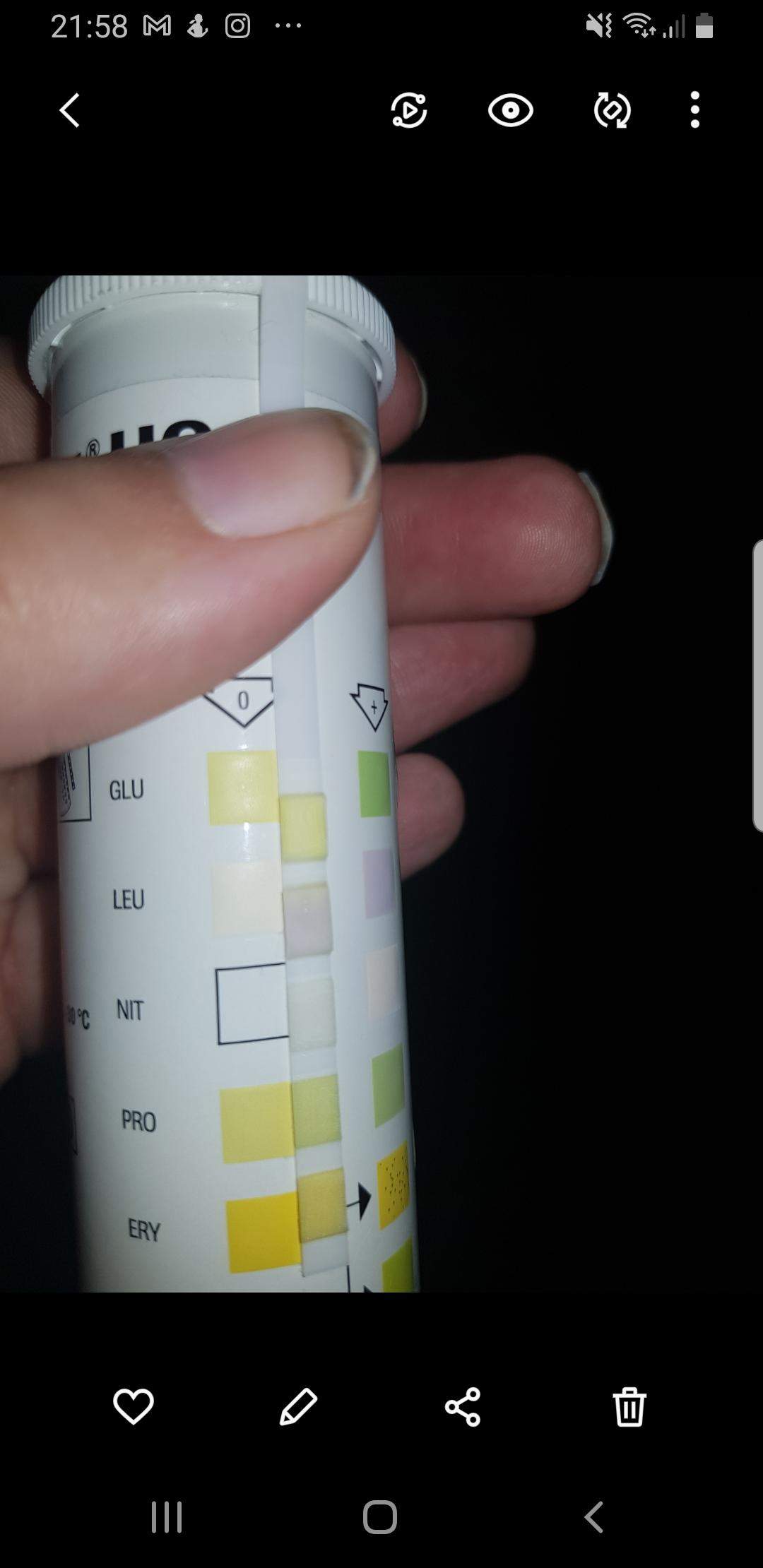 Combur test Urin? (Gesundheit und Medizin, Urintest)