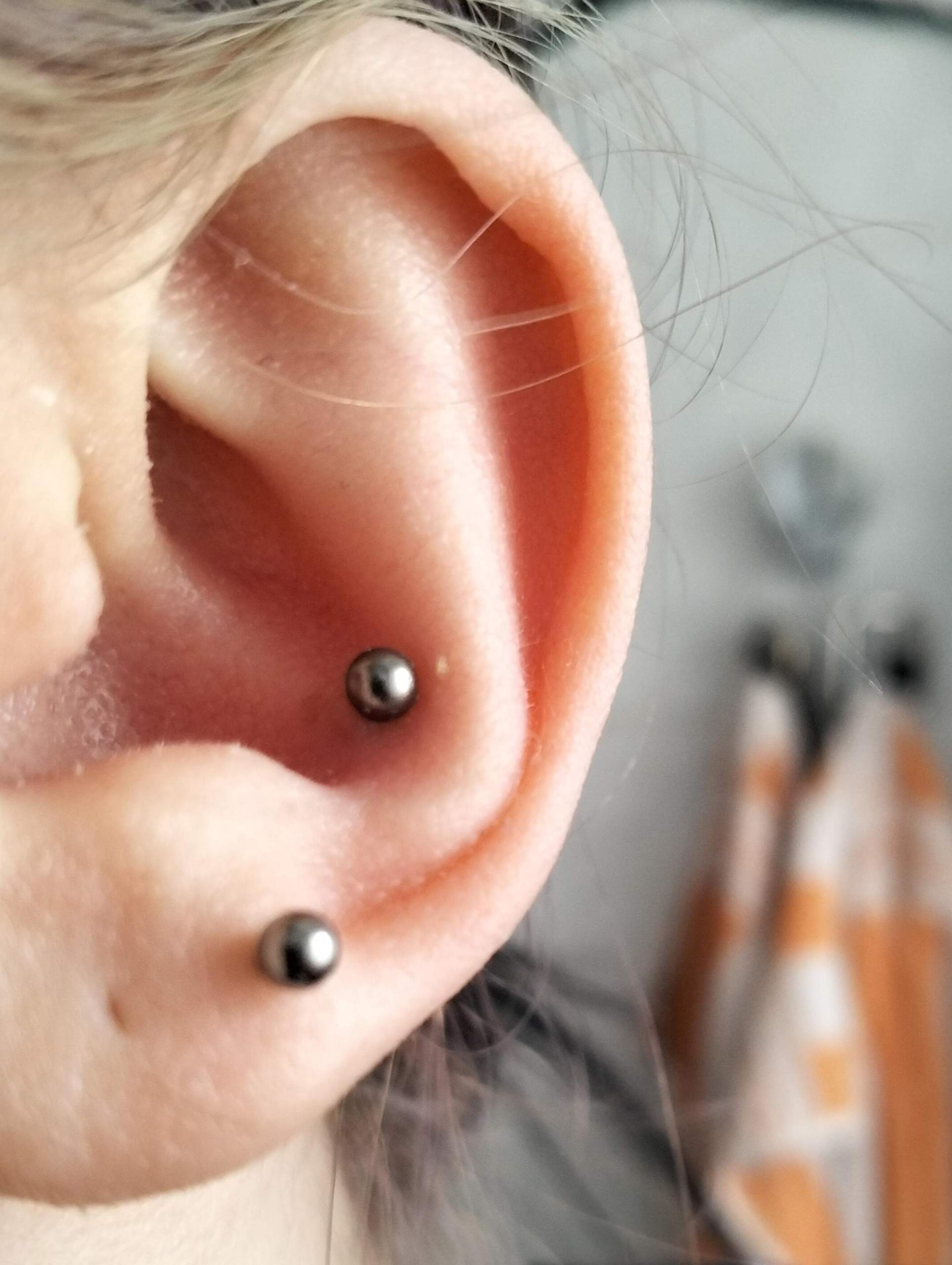 Conch Wildfleisch geht nicht weg? (Piercing, Entzündung, Ohr)