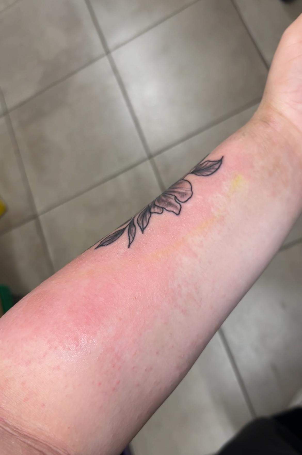 Entzündung bei tattoo?? (Pflege, Tattoopflege)