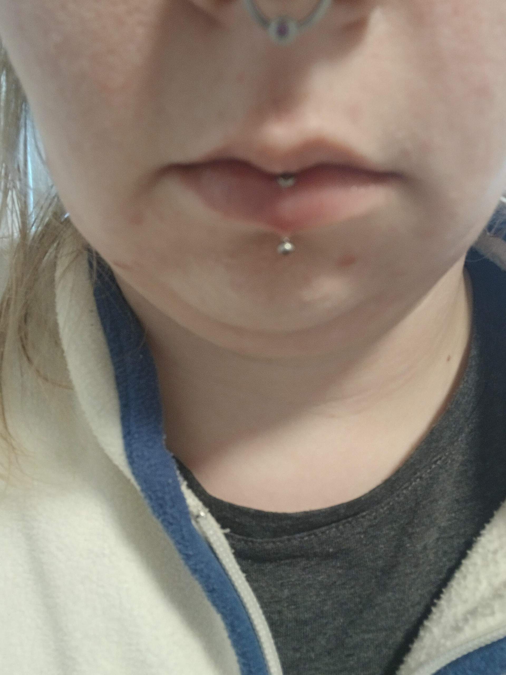 Eskimo Piercing verheilt nicht? (Schmerzen, Pflege, Entzündung)