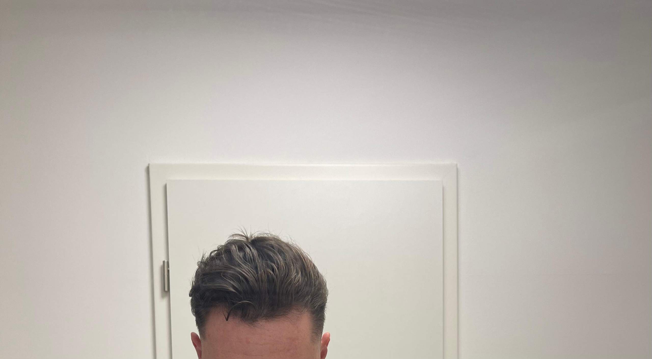 Findet ihr das sind Geheimratsecken? Plötzlich nach tragen von locken ...