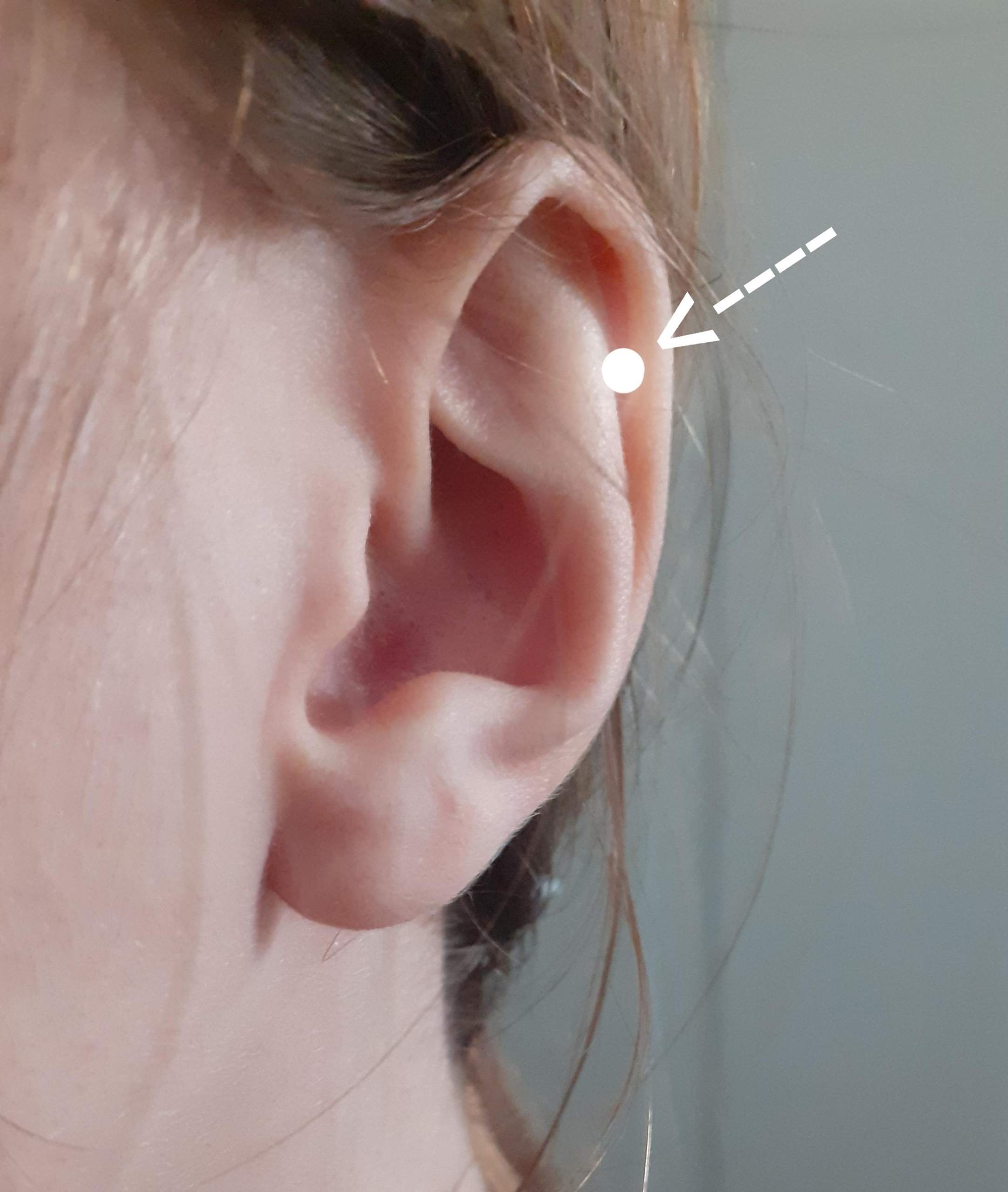 Findet ihr ein Helix links oder rechts schöner? (Aussehen, Piercing, Ohr)