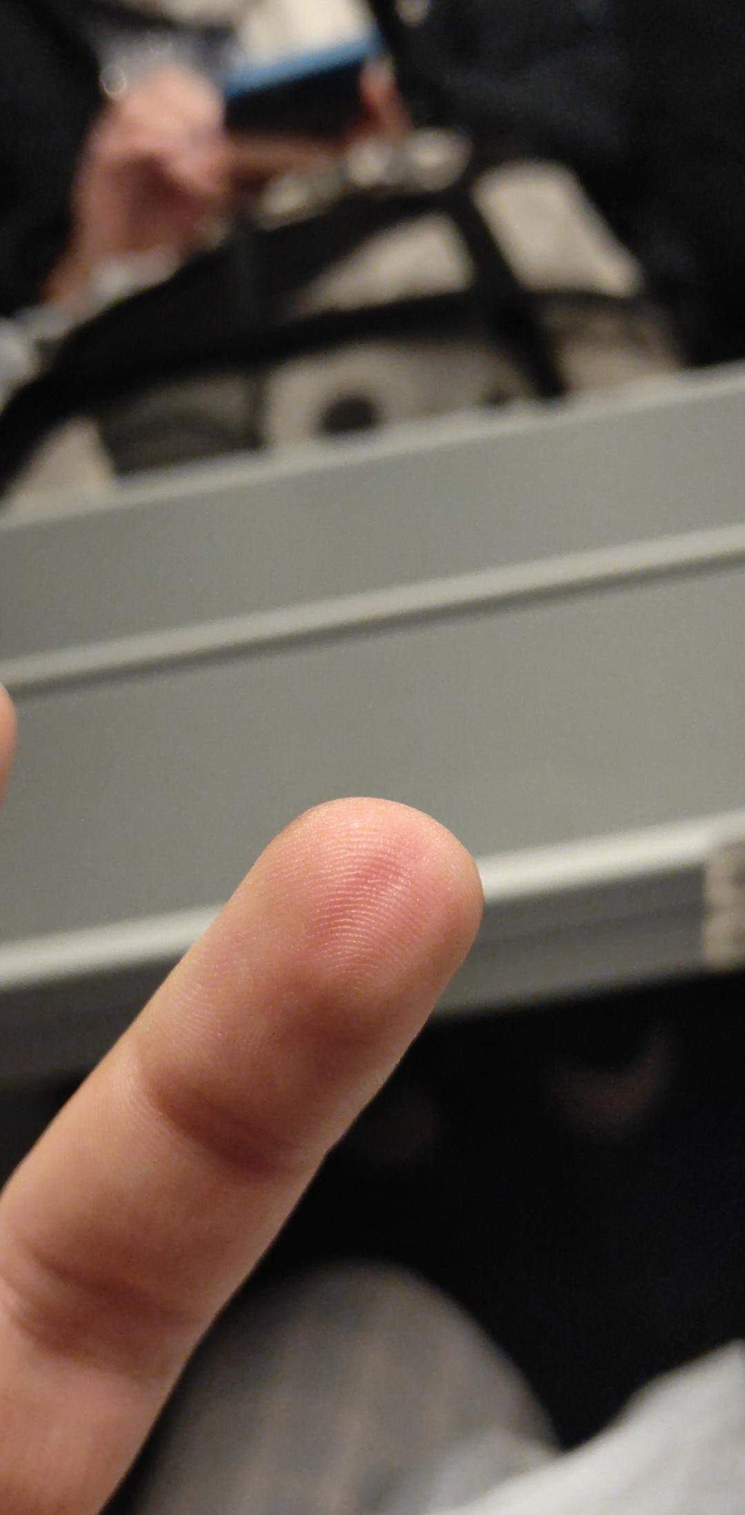 Fingerkuppe Abdrücke? (Gesundheit und Medizin, Arzt, Neurologie)