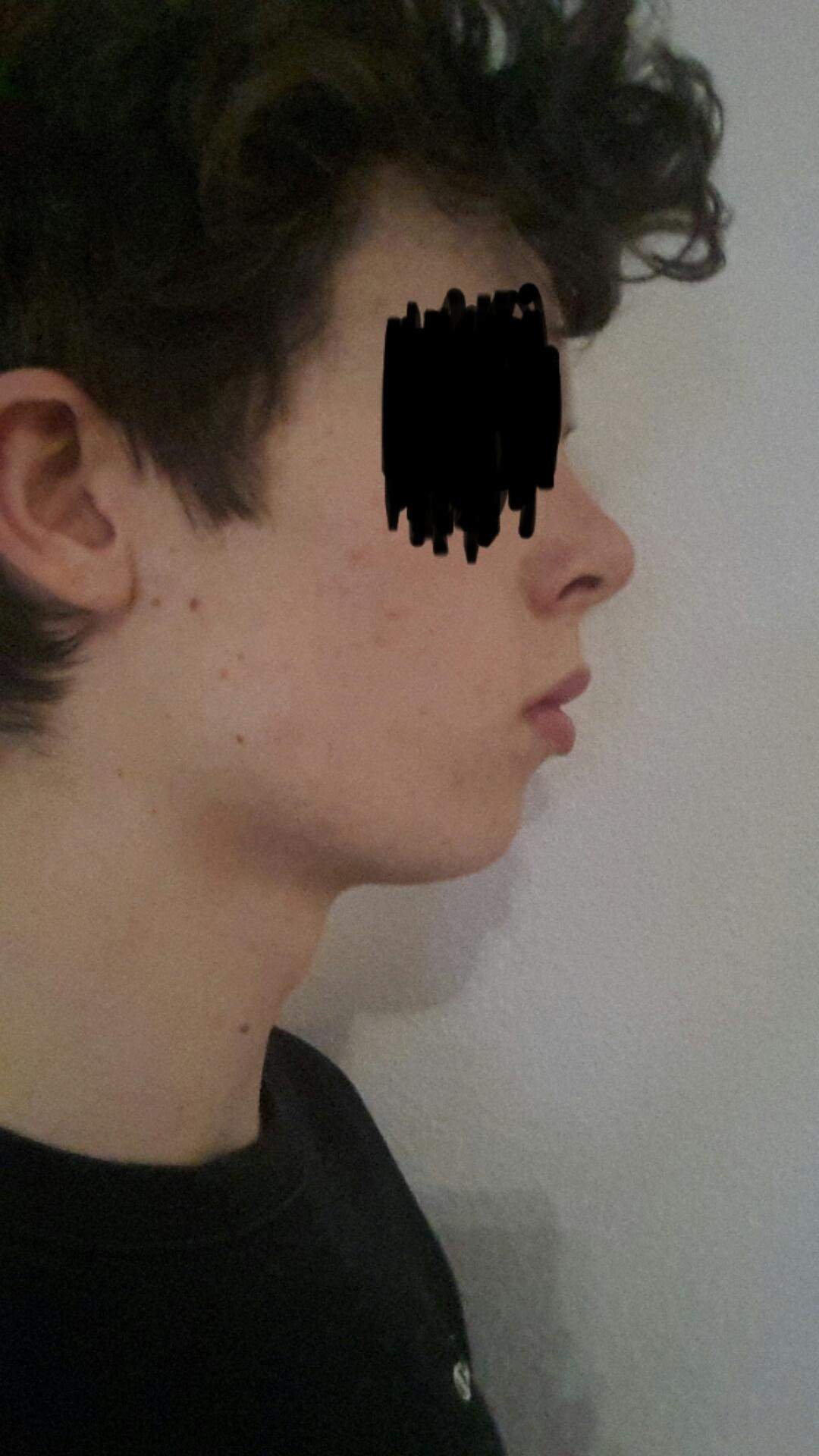 Fliehendes Kinn? (Gesundheit und Medizin, Gesundheit, Körper)