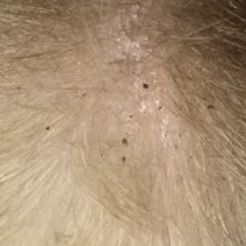 Flohkot oder Dreck? (Tiere, Katzen)