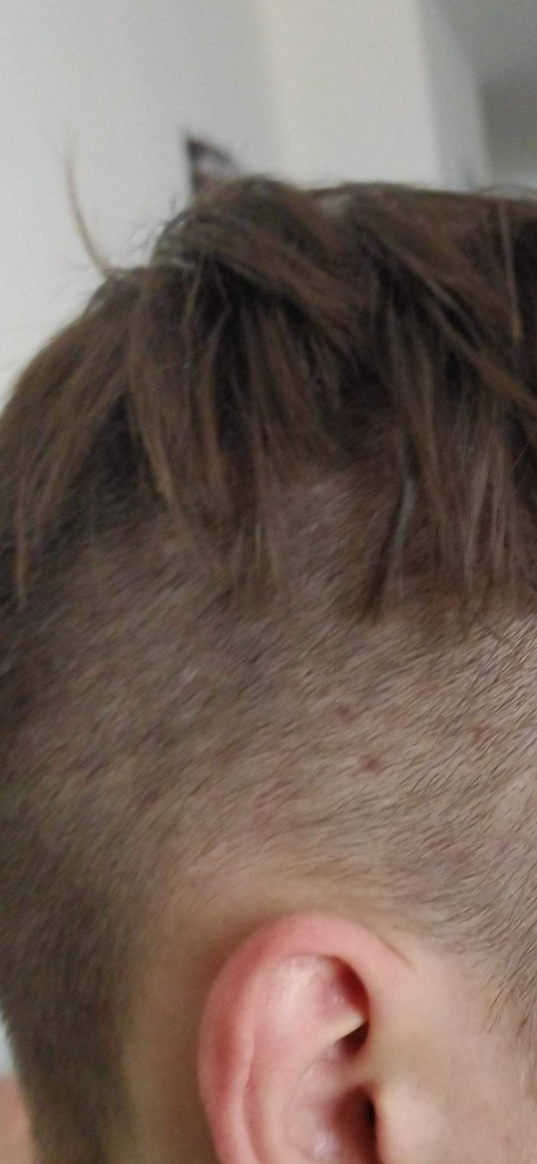Frisur total verschnitten? (Undercut)
