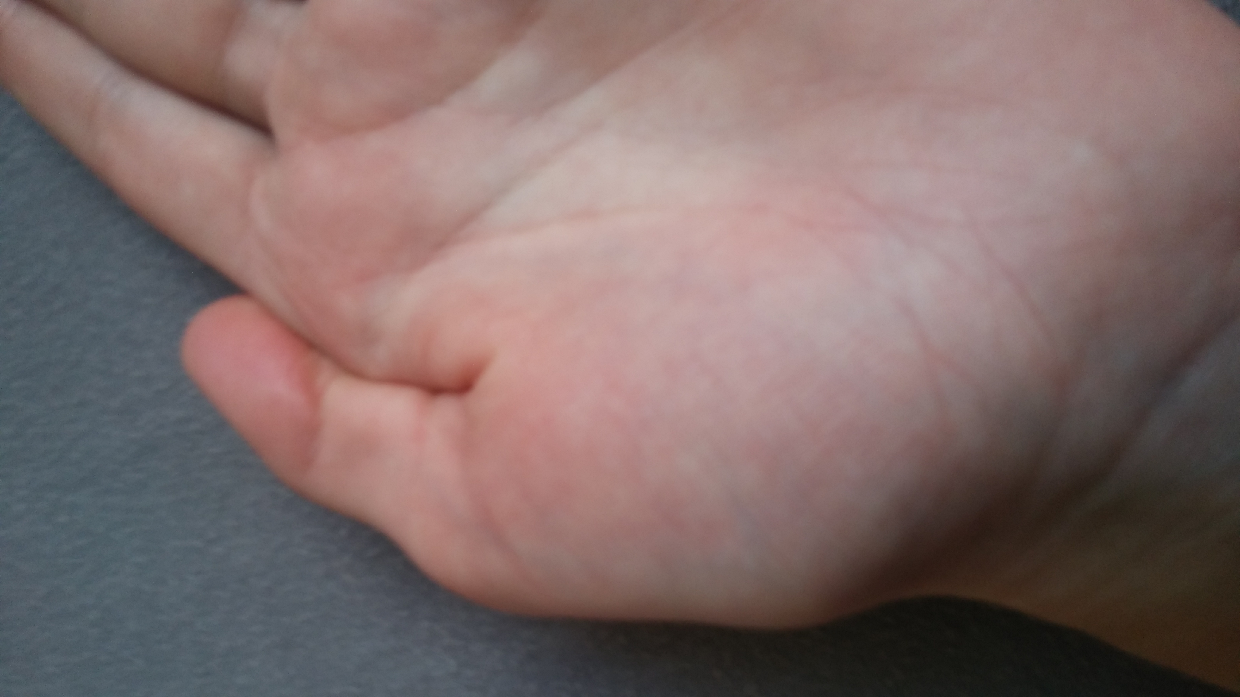 Gefährlich?Muskelschwund?Atrophie? (Computer, Gesundheit und Medizin ...