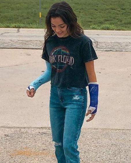 Gips? (Gipsbein, Gipsarm)