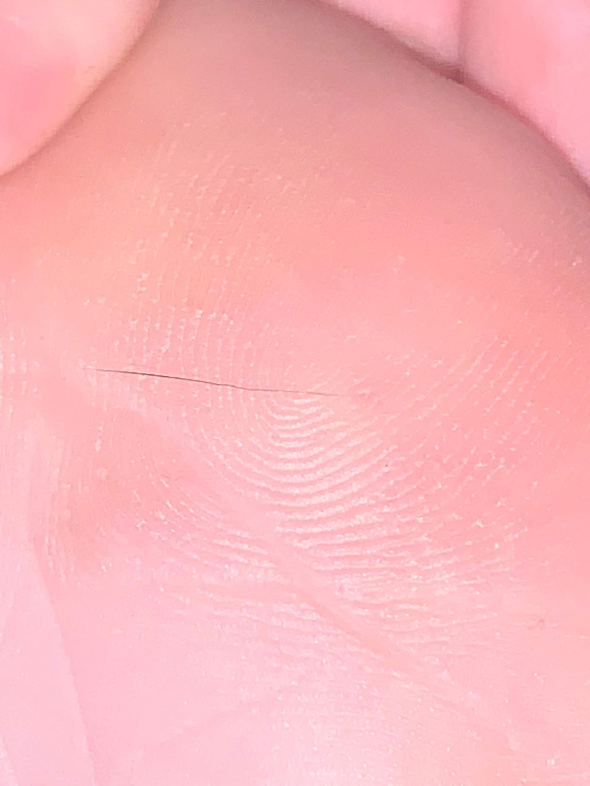 Haar im fuß? (Gesundheit und Medizin, Gesundheit, Haare)