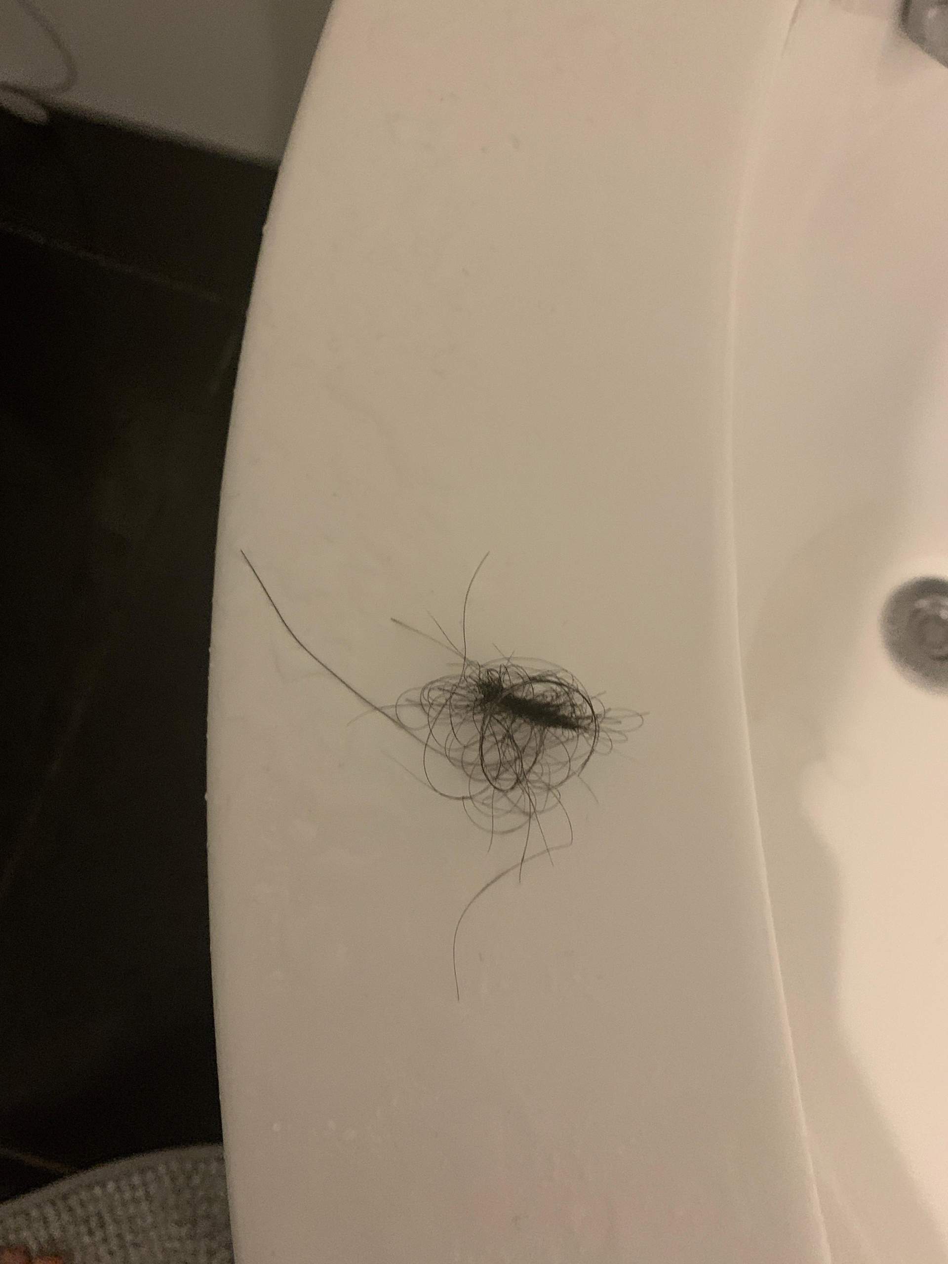 Haarausfall? (Männer, Kopfhaut)