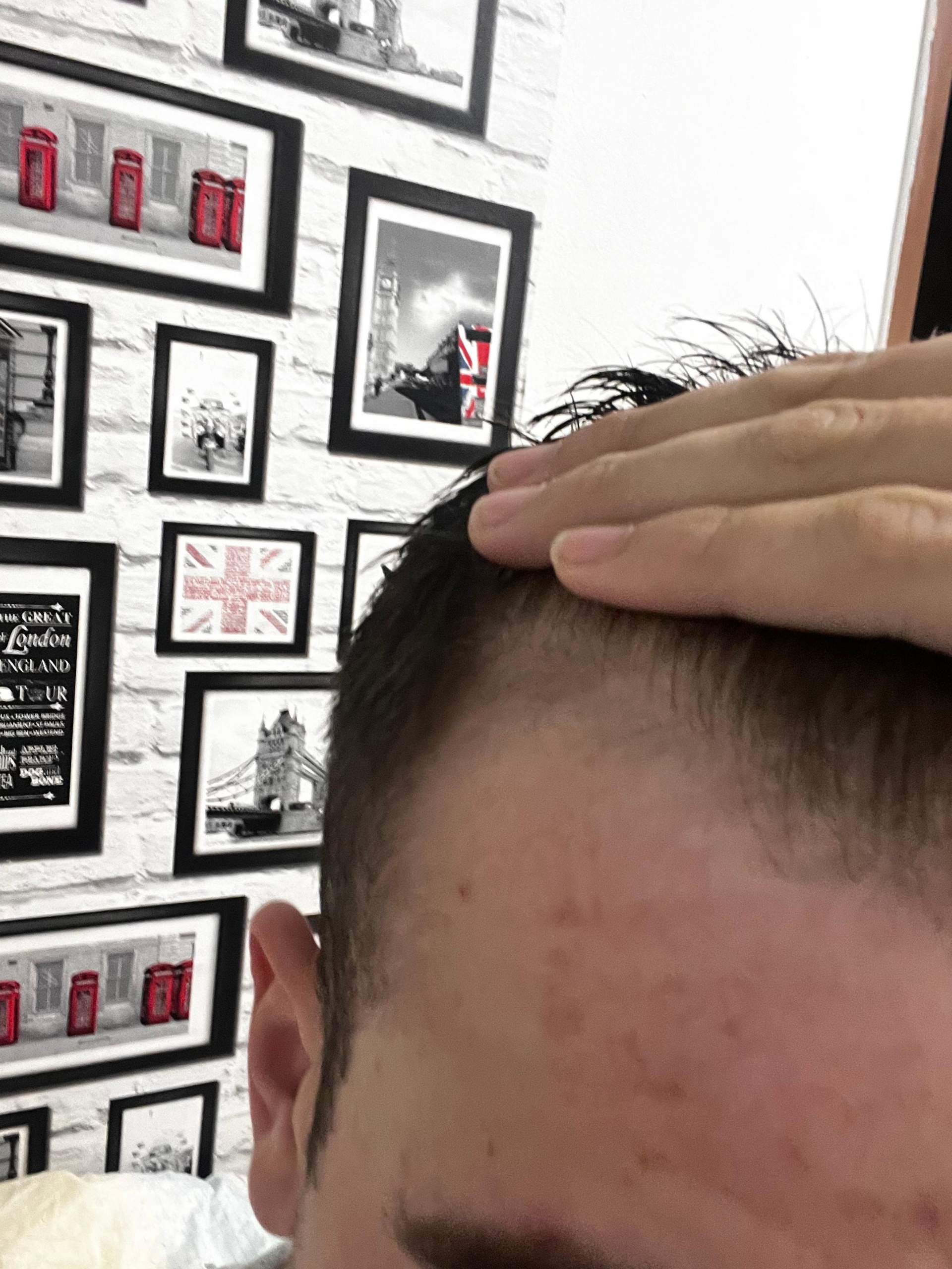 Haarausfall? (Männer, Friseur, Geheimratsecken)
