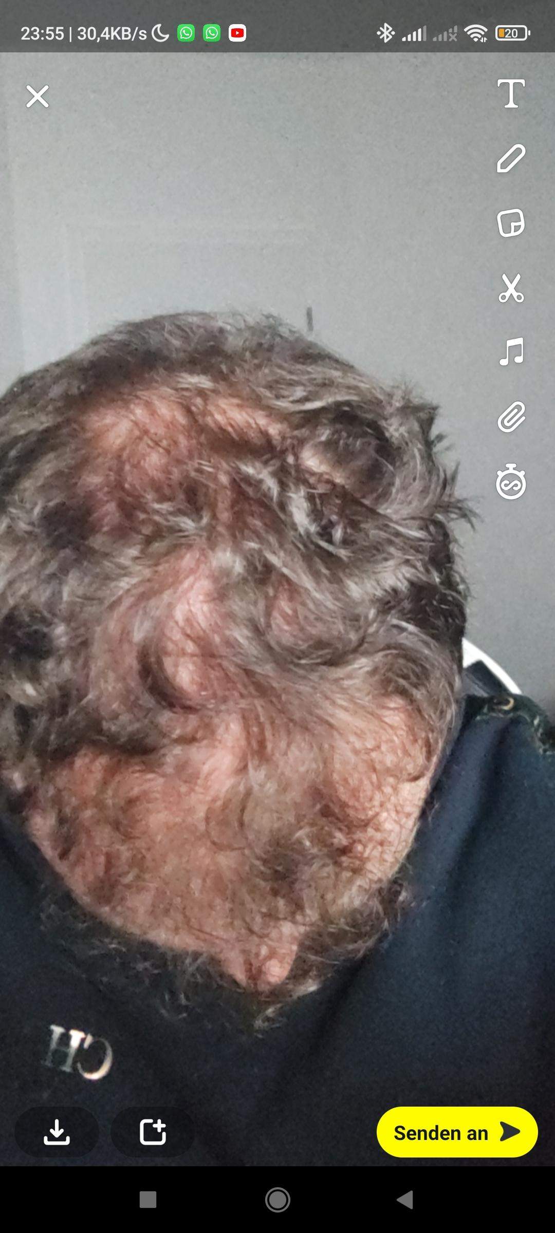 Haarausfall? (Männer, Aussehen, Pubertät)