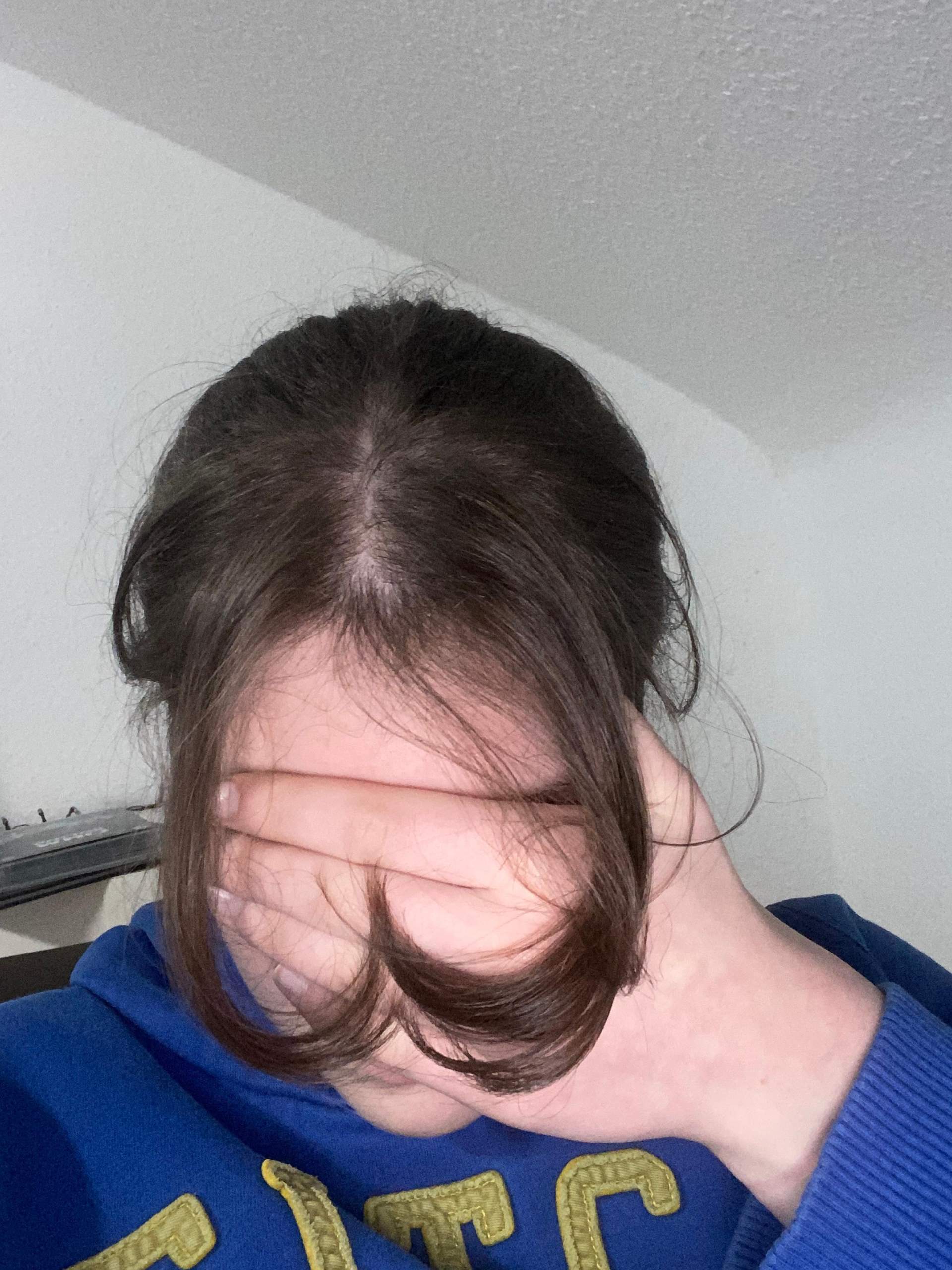 Haare im Scheitel, was tun? (Aussehen, Friseur, Styling)