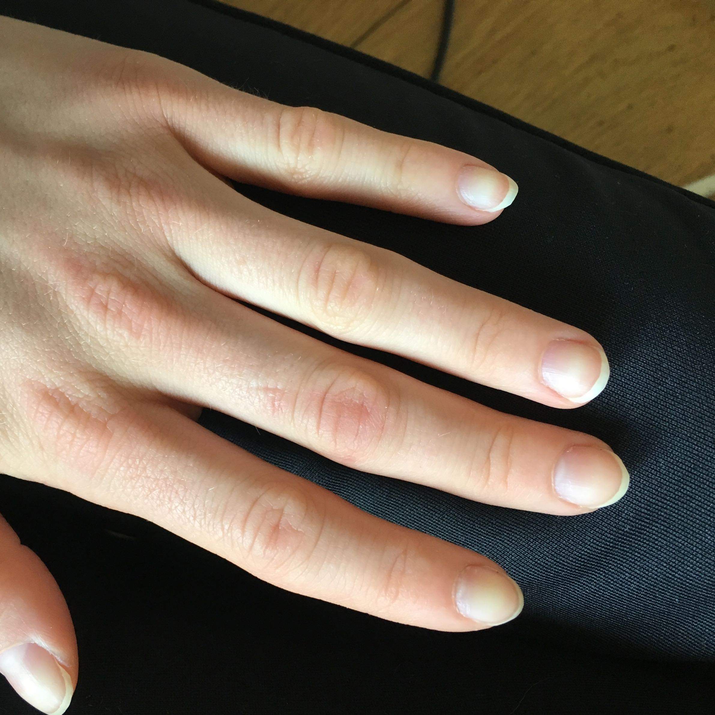 Hab ich zu knochige Hände?? (Finger)