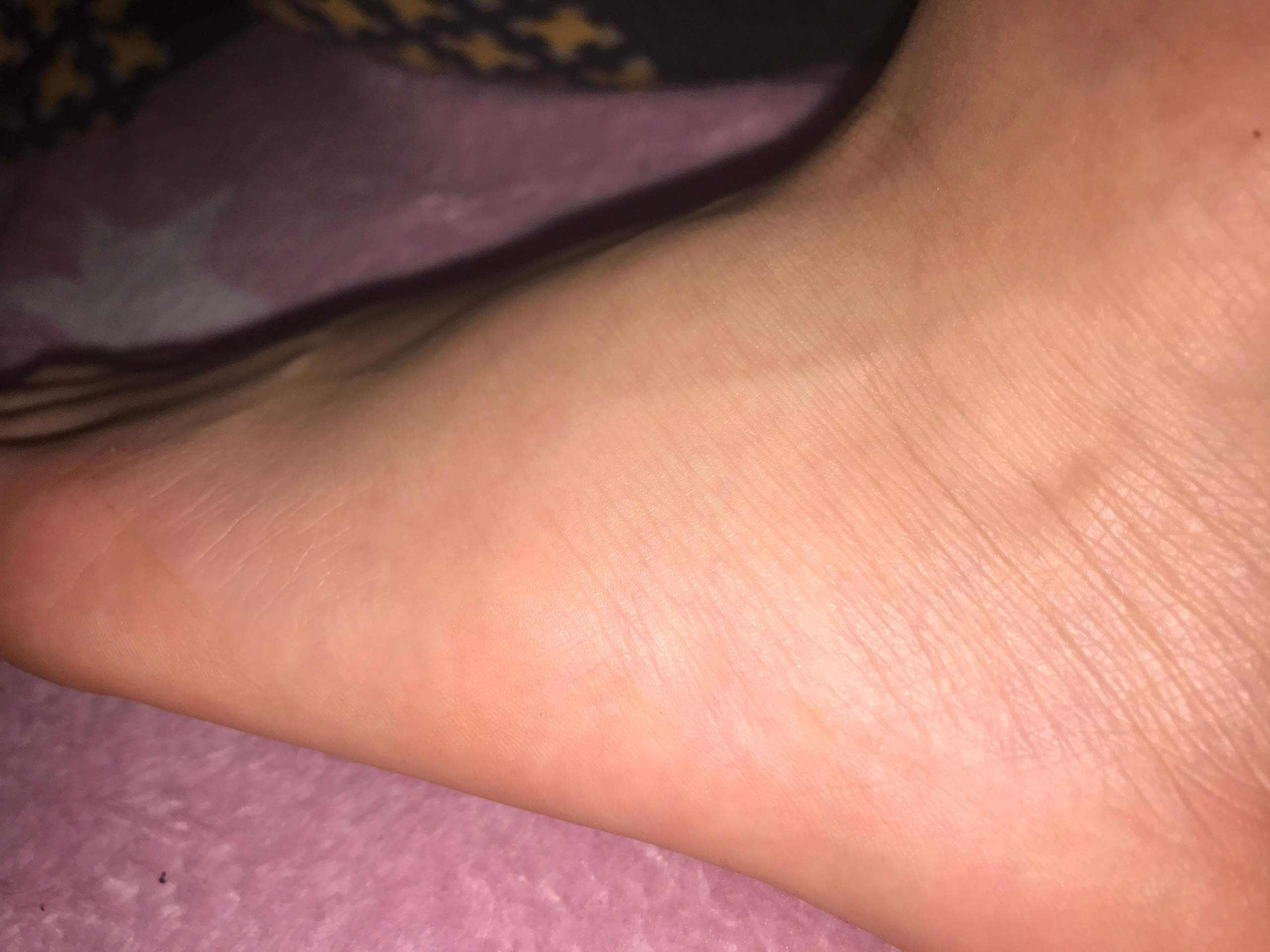 Habe ich die bänder gerissen? (Gesundheit und Medizin, Band, Volleyball)