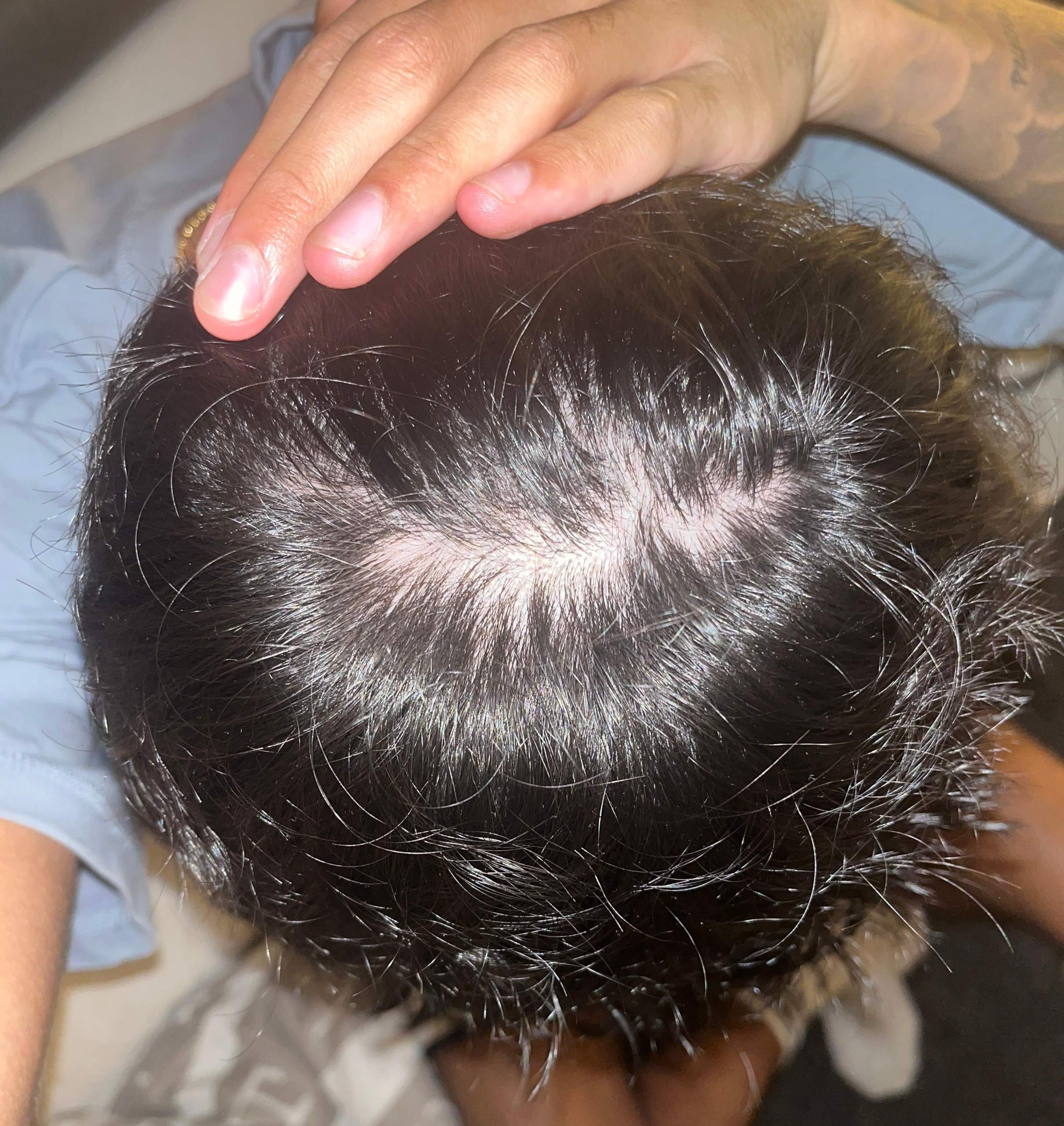 Habe ich Haarausfall?