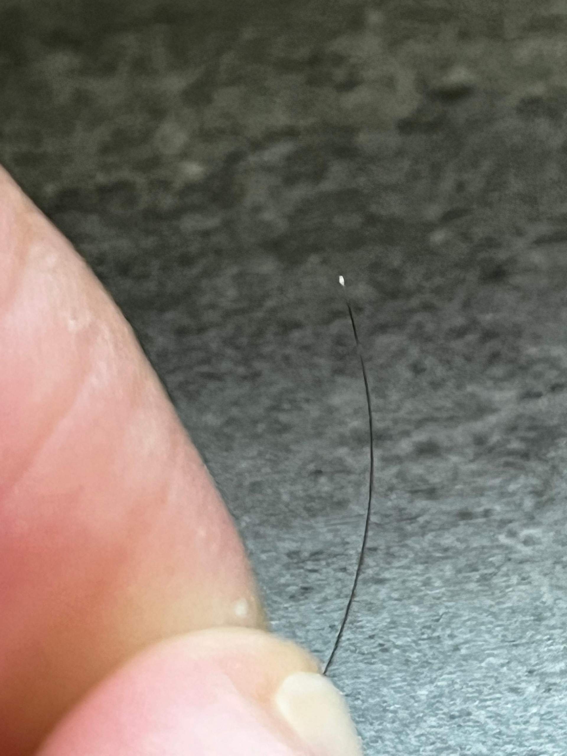 Habe ich Haarausfall? (Aussehen, Pflege, Friseur)