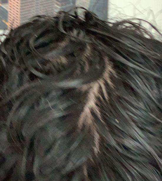 Habe ich Haarausfall oder ist das mein Scheitel? (Pubertät, Pflege ...