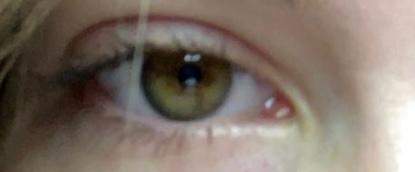Habe ich Hazel eyes? (Augen, Augenfarbe)