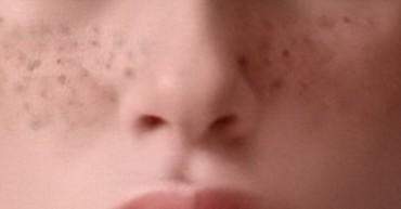 Hässliche nase? (Beauty, Girl)