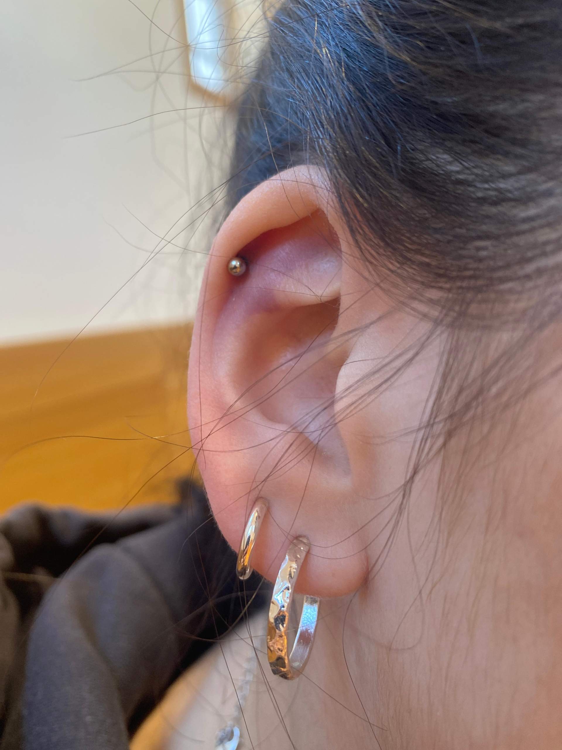 Haut um Piercing ist lila? (Ohr, Helix)