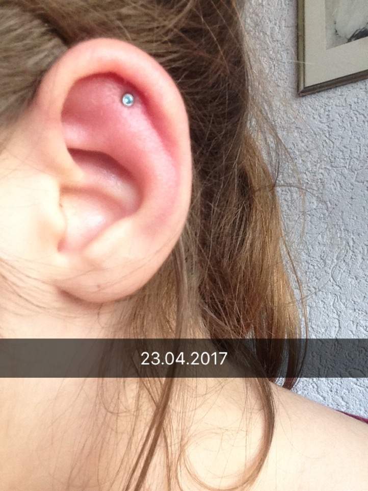 Helix nach 1 1/2 Monaten angeschwollen, ist das normal? (Piercing) Helix nach 1 1/2 Monaten angeschwollen, ist das normal? (Piercing)