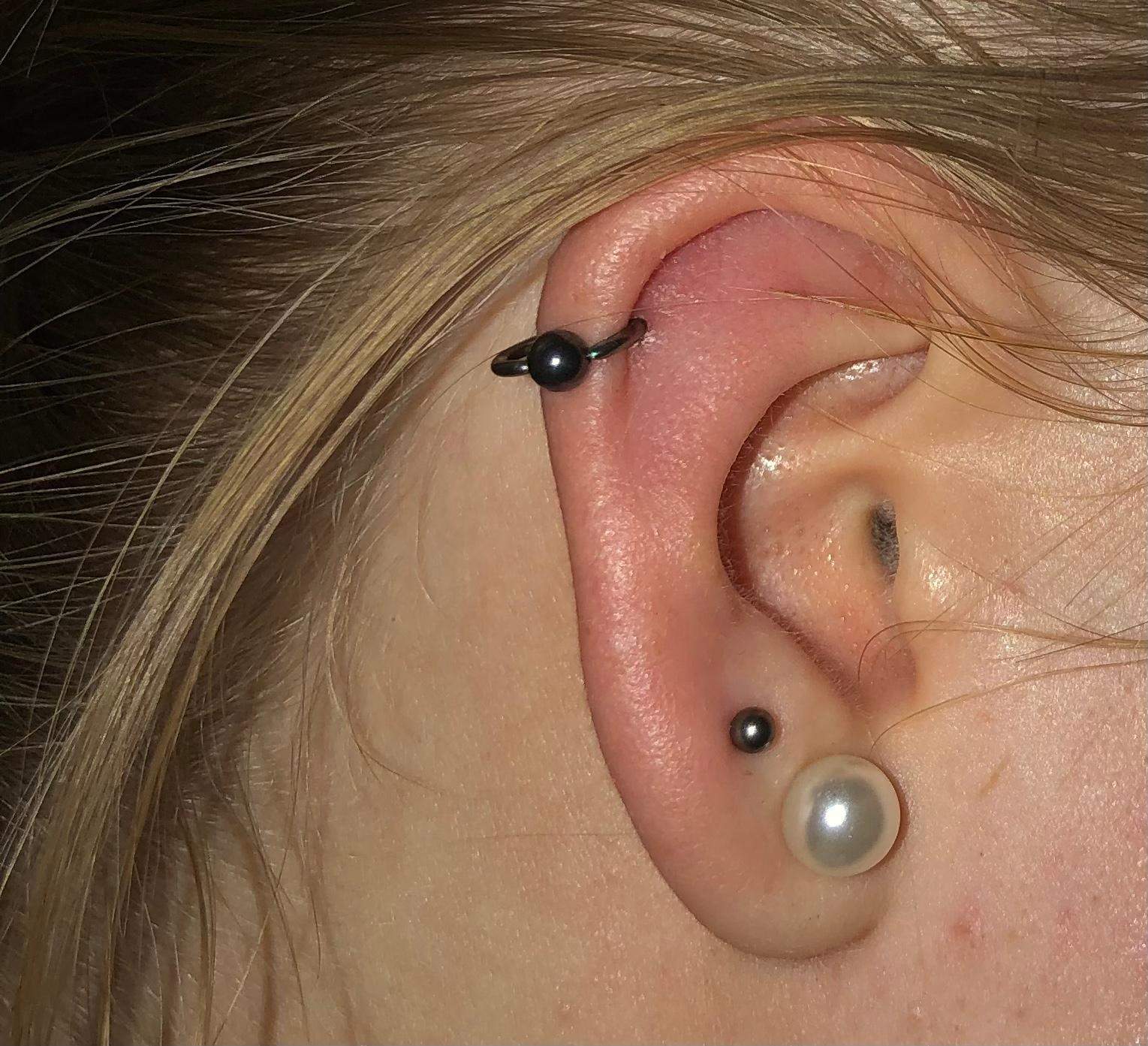 Helix-Rötung normal? (Gesundheit und Medizin, Pflege, Piercing)