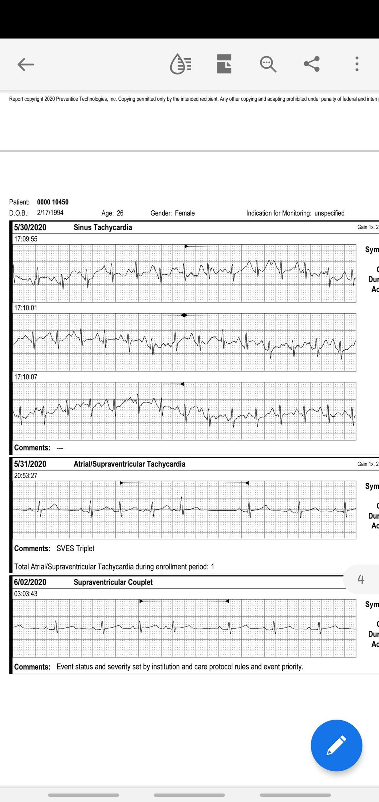 HERZ ----- SVES/ VES machen mich verrückt, wer kennts? (Gesundheit und ...