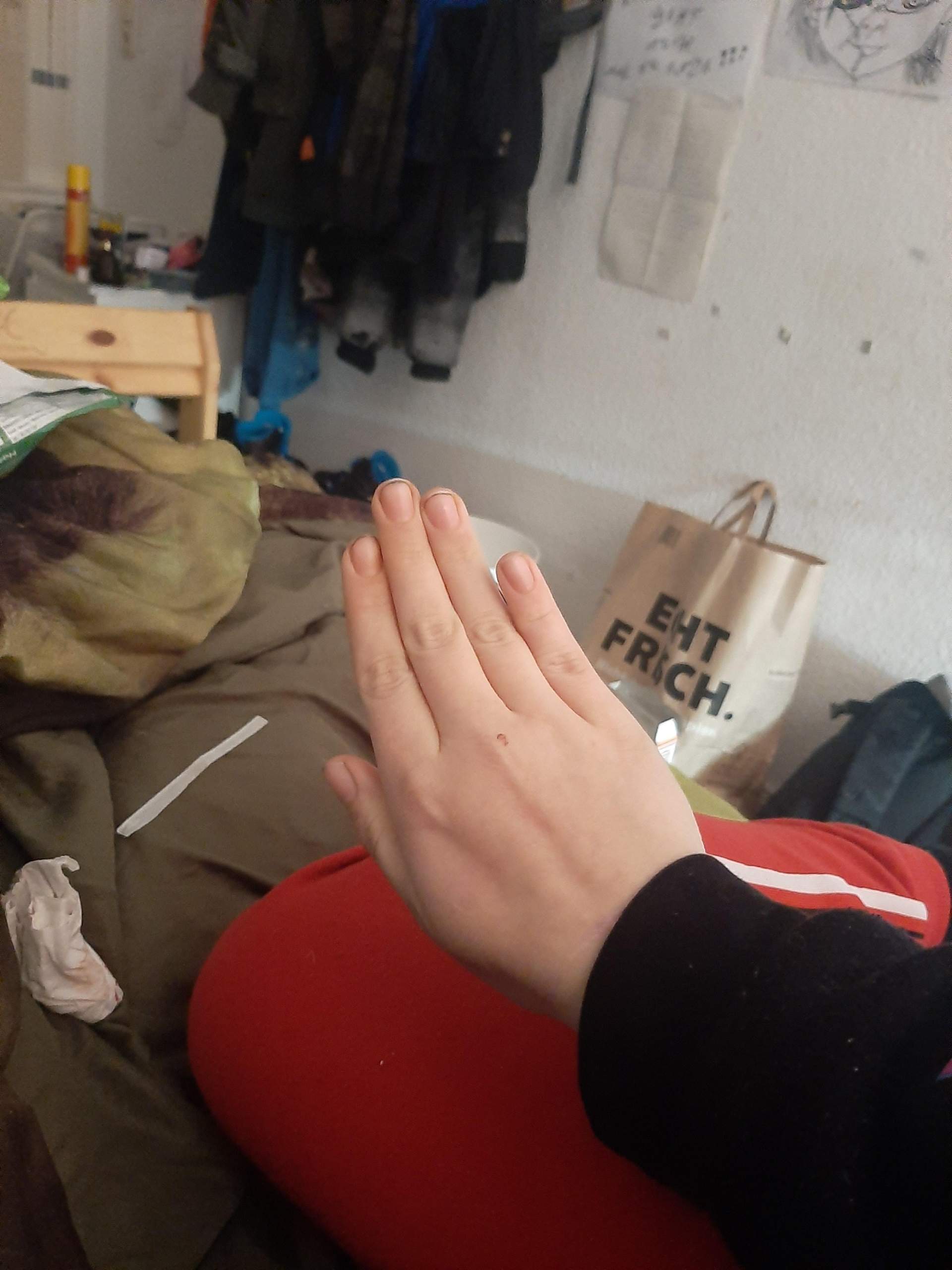 Hey hab mal eine frage ist das normalwas der kleine Finger anders ist ... Hey hab mal eine frage ist das normalwas der kleine Finger anders ist ...